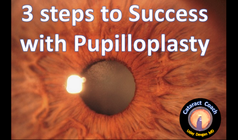 3 Steps to Success with Pupilloplasty – Cataract Coach