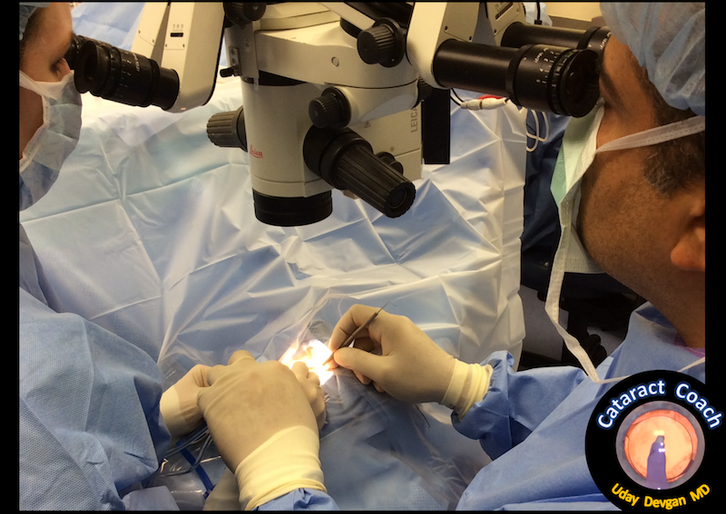 Why have a Cataract Coach? – Cataract Coach