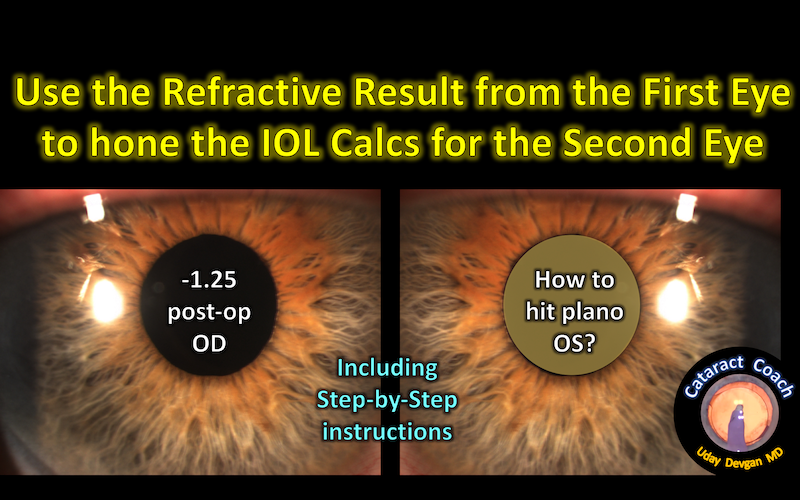 Learning from the IOL Calcs of the First Eye – Cataract Coach