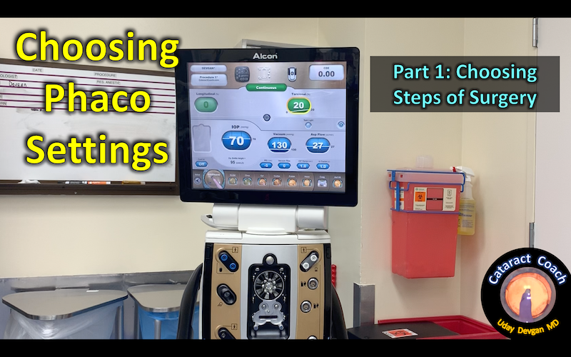 Phaco Fundamentals Part 1: Choosing Steps of Surgery – Cataract Coach