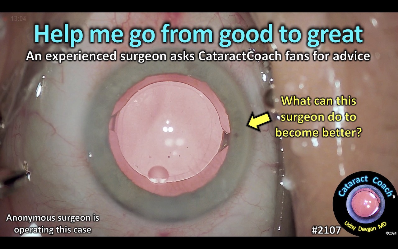 2107 surgeon asks for help – Cataract Coach™