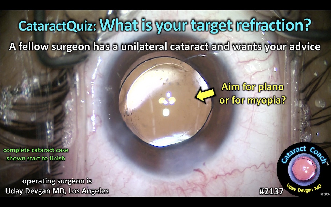 2137 quiz refractive target – Cataract Coach™