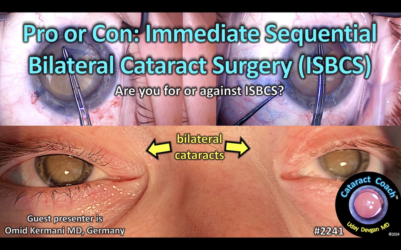 Screenshot – Cataract Coach™