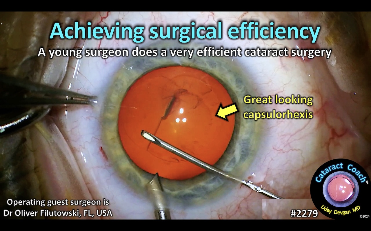 Screenshot – Cataract Coach™