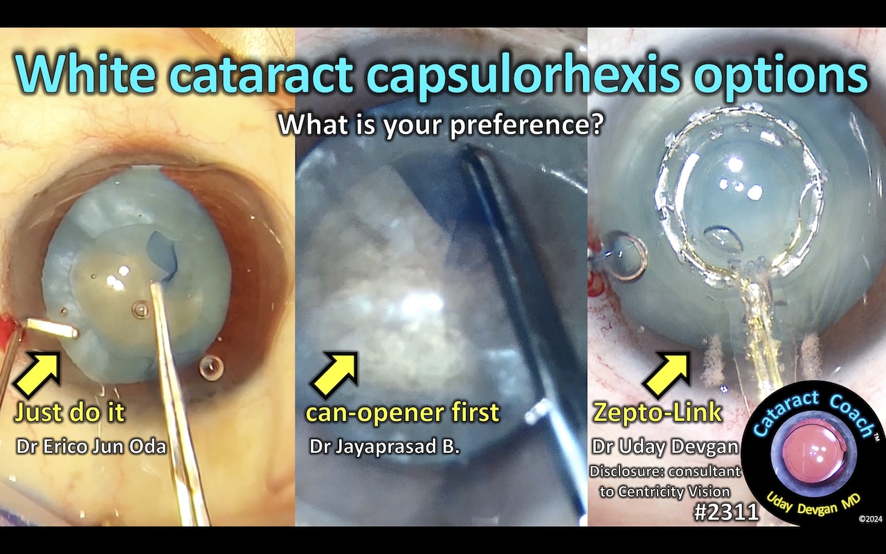 Screenshot – Cataract Coach™