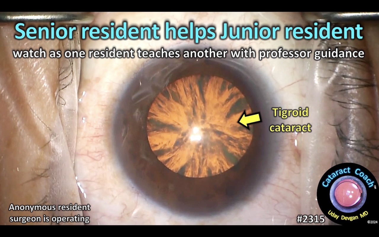 Screenshot – Cataract Coach™