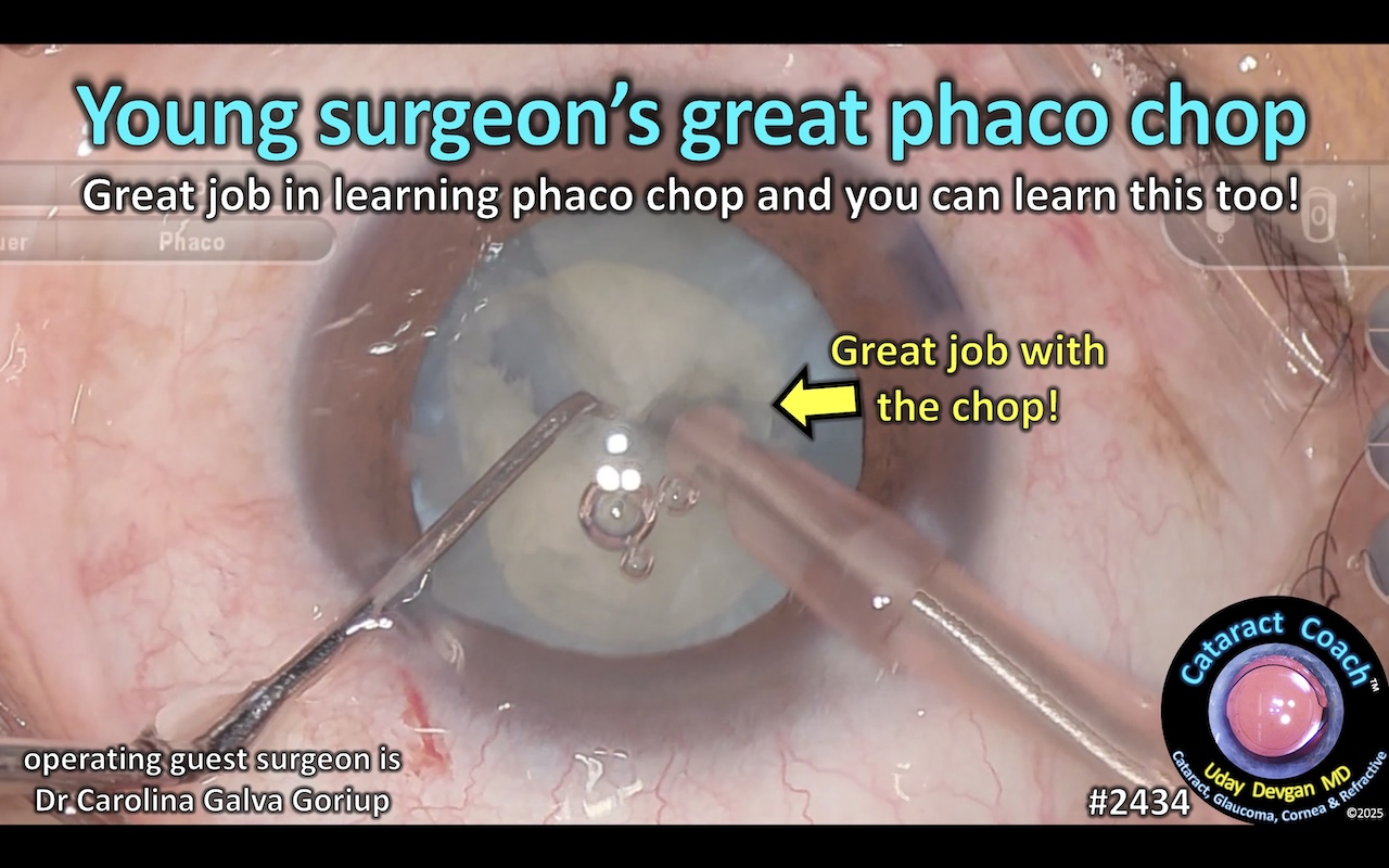 Screenshot – Cataract Coach™