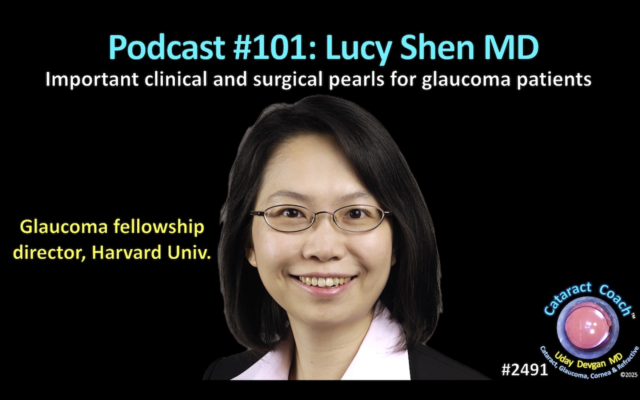 CataractCoach Podcast 101: Lucy Shen MD glaucoma at Mass Eye Harvard